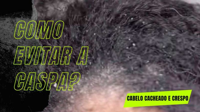 Como acabar com a caspa em cabelo cacheado e crespo? 3 dicas | Luiza ...